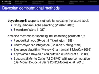 bayesImageS: Bayesian computation for medical Image Segmentation using a hidden Potts Model | PPT
