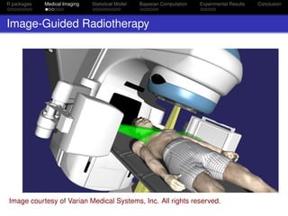bayesImageS: Bayesian computation for medical Image Segmentation using a hidden Potts Model | PPT