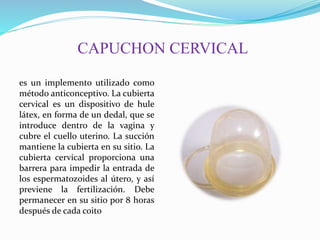 Método anticonceptivos | PPT