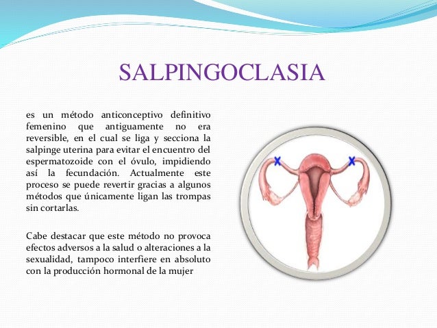 Método anticonceptivos
