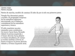 Método de tratamiento Temple Fay - Neurofacilitación | PPTX