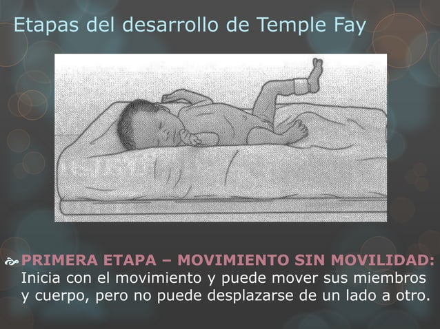 Método de tratamiento Temple Fay - Neurofacilitación | PPTX | Physical ...
