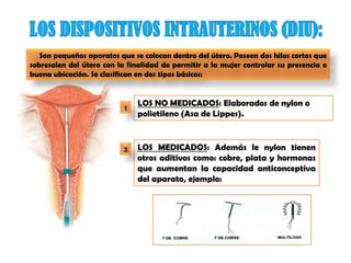 MÉTODOS ANTICONCEPTIVOS. | PPTX