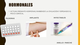 MÉTODOS ANTICONCEPTIVOS GINECOLOGIA.pptx