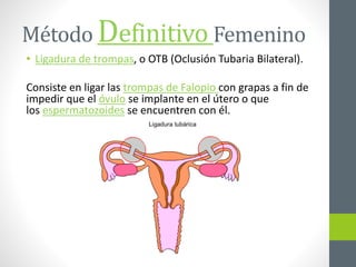 Métodos anticonceptivos quirúrgicos | PPTX