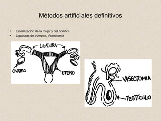 Métodos anticonceptivos pp | PPT