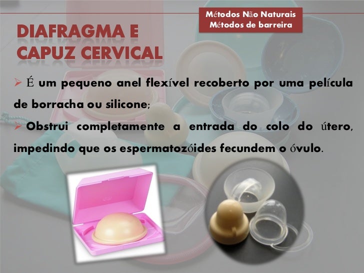 Métodos contraceptivos