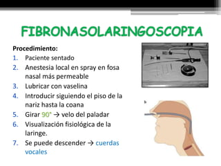 Métodos exploración laringe | PPTX