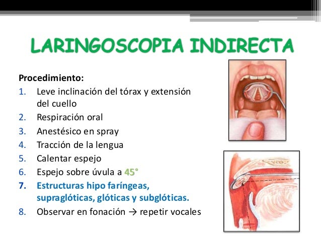 Métodos exploración laringe