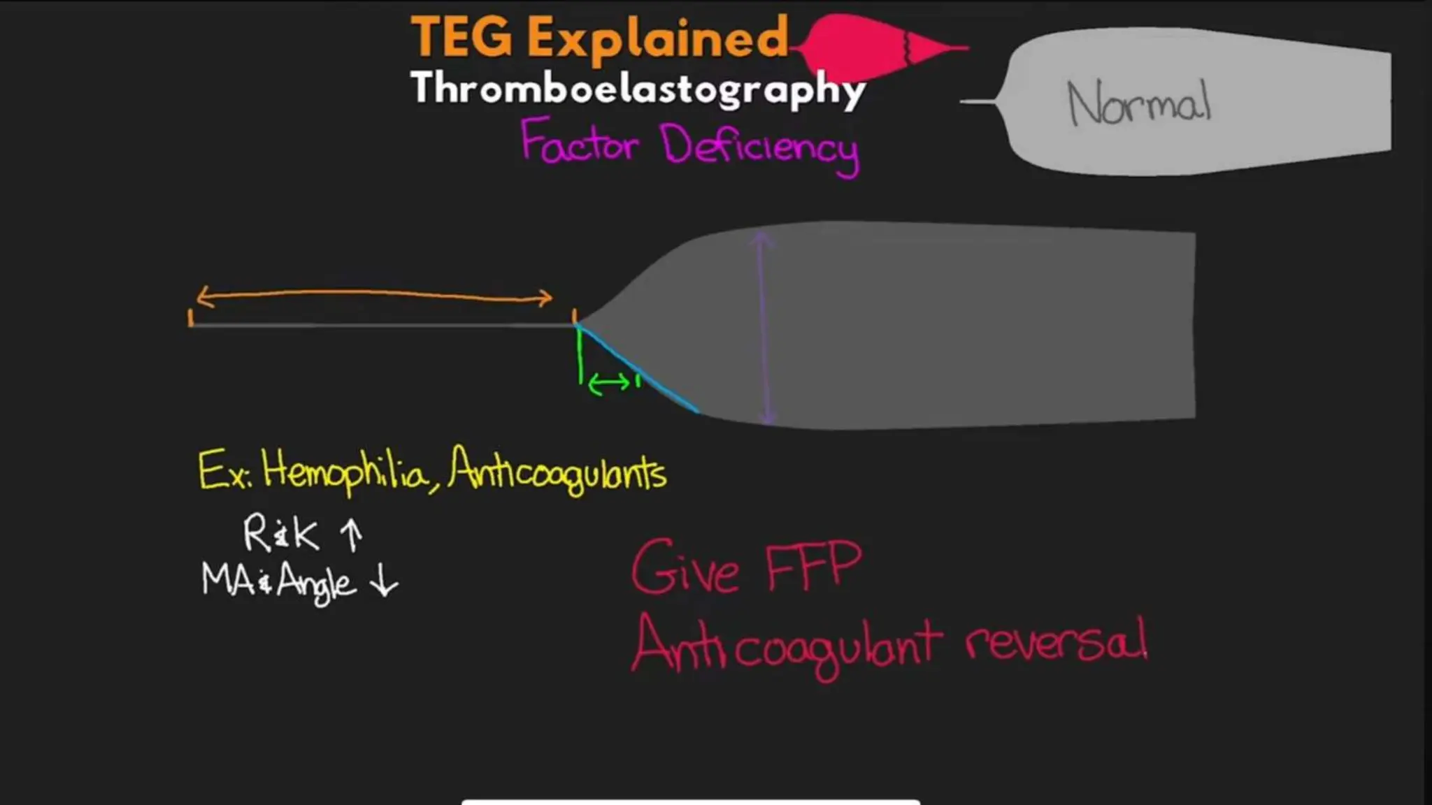 MASSIVE TRANSFUSION PROTOCOLS by DR JUVERIA.pptx | First Aid | Injuries