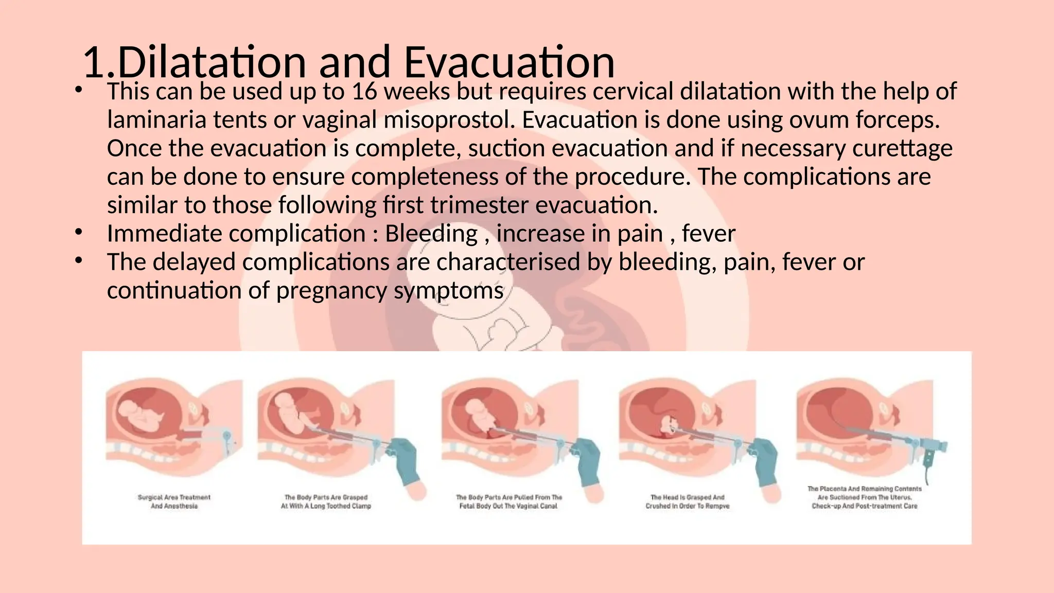 MTP Act Presentation.pptx medical termination of pregnancy | PPTX