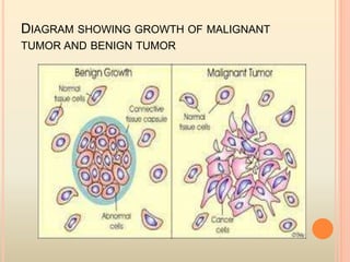 oncology | PPTX