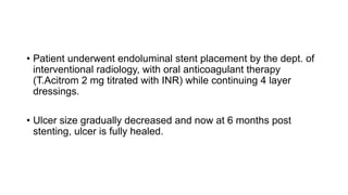 A clinical Case of May thurner syndrome .pptx