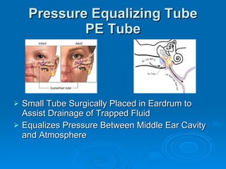 M T Sp Senses Pr | PPT | Ear, Nose and Throat Conditions | Diseases and ...