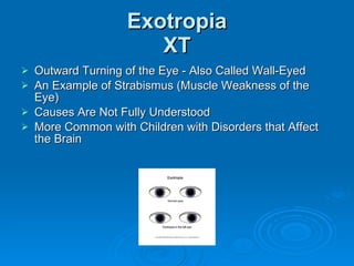 M T Sp Senses Pr | PPT | Ear, Nose and Throat Conditions | Diseases and ...