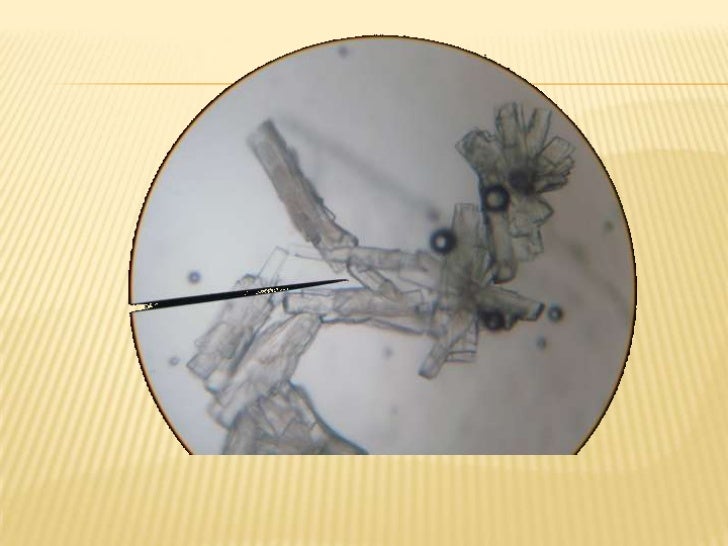 Mucic and Barfoeds Test