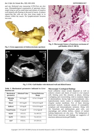 Mucinous Carcinoma of Gall Bladder an Incidental Finding of a Rare Case ...