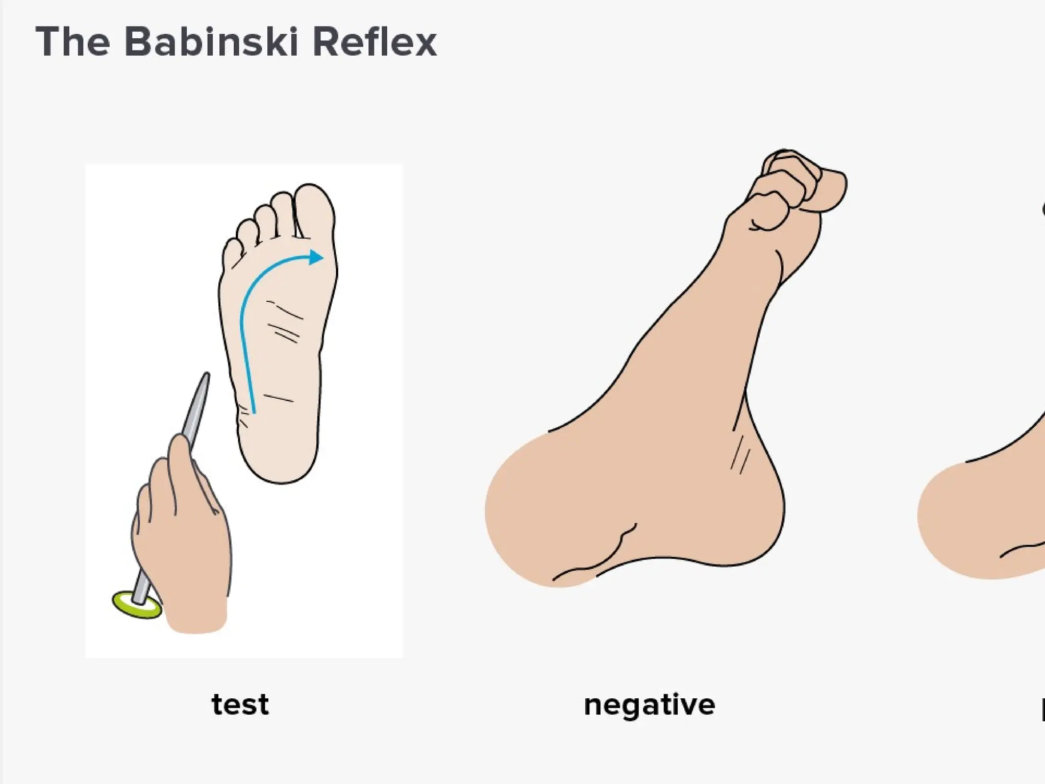 REFLEXES TYPES LEVELS TESTING PROCEDURES.pptx
