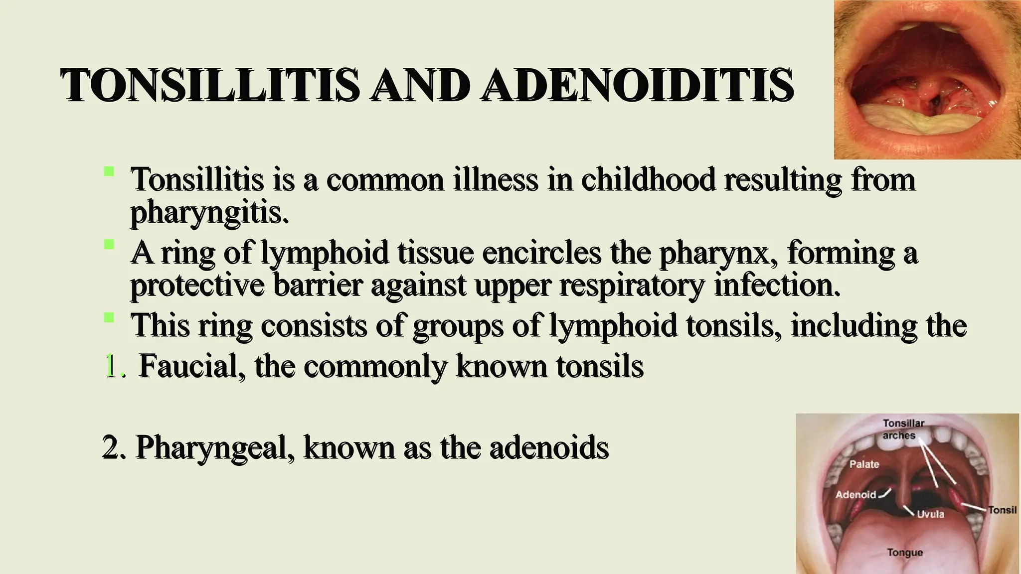Anatomy of the child’s respiratory tract | PPT