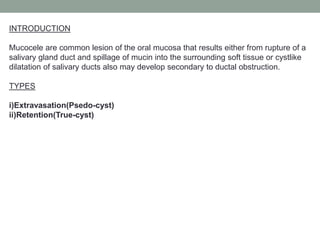 Mucocele | PPTX