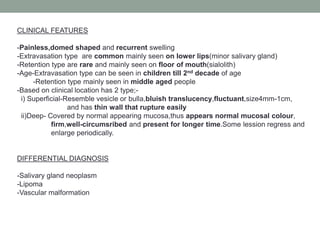 Mucocele | PPTX
