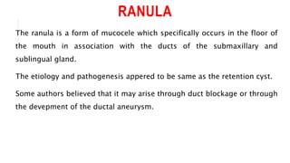 Mucocele and Renula | PPTX | Ear, Nose and Throat Conditions | Diseases ...