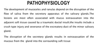 Mucocele and Renula | PPTX | Ear, Nose and Throat Conditions | Diseases ...