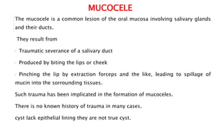 Mucocele and Renula | PPTX | Ear, Nose and Throat Conditions | Diseases ...