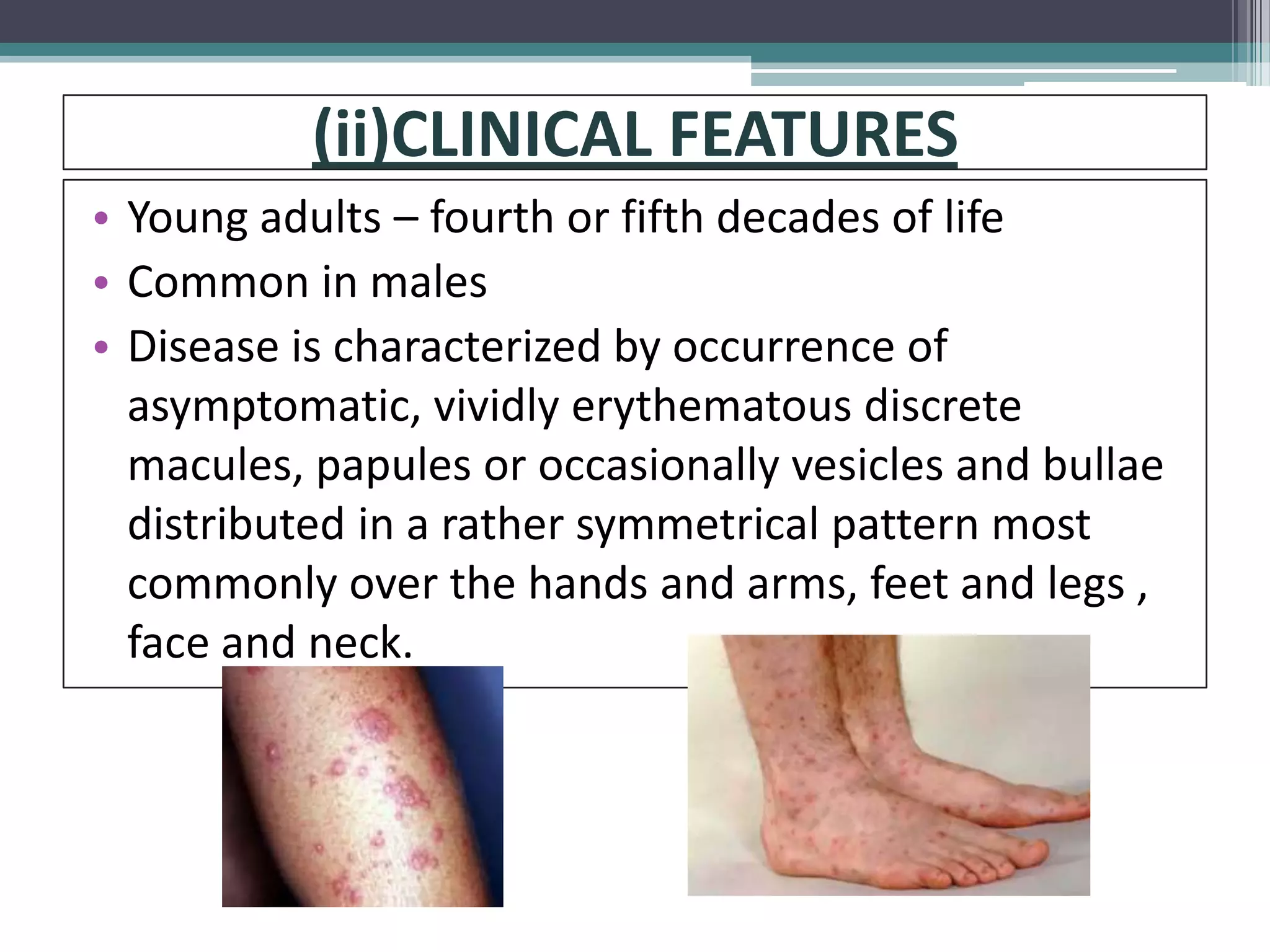 Mucocutaneous | PPTX