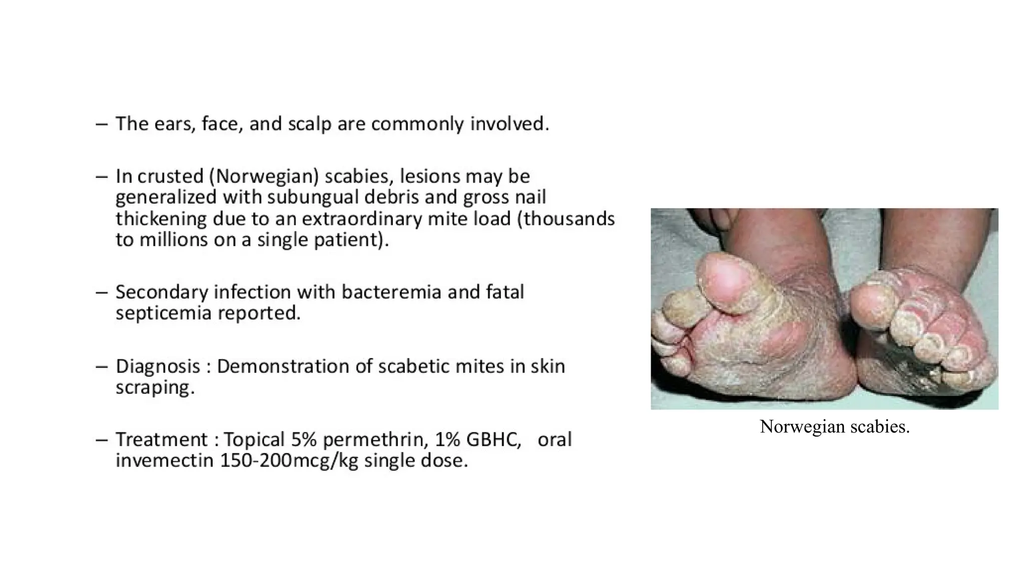Mucocutaneous HIV Manifestations and diagnosis | PPTX