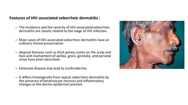 Mucocutaneous HIV Manifestations and diagnosis | PPTX | Skin and ...