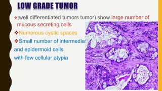 Mucoepidermoid carcinoma | PPTX