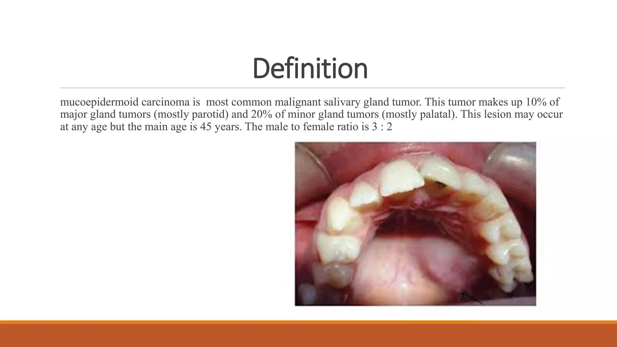 Mucoepidermoid carcinoma ppt | PPTX