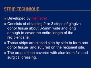 mucogingival surgeries.pptx