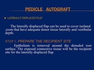mucogingival surgeries.pptx