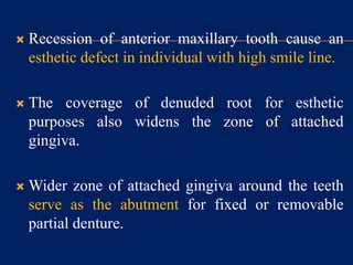mucogingival surgeries.pptx