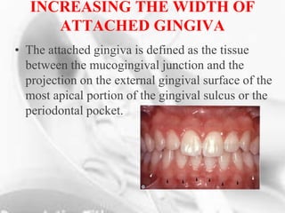 Mucogingival surgeries other than soft tissue grafts | PPTX