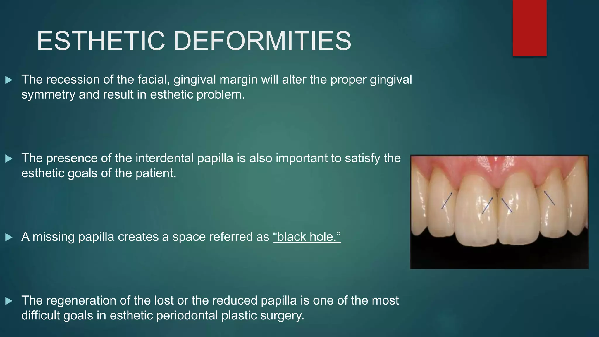 Mucogingival surgery in periodontics | PPTX