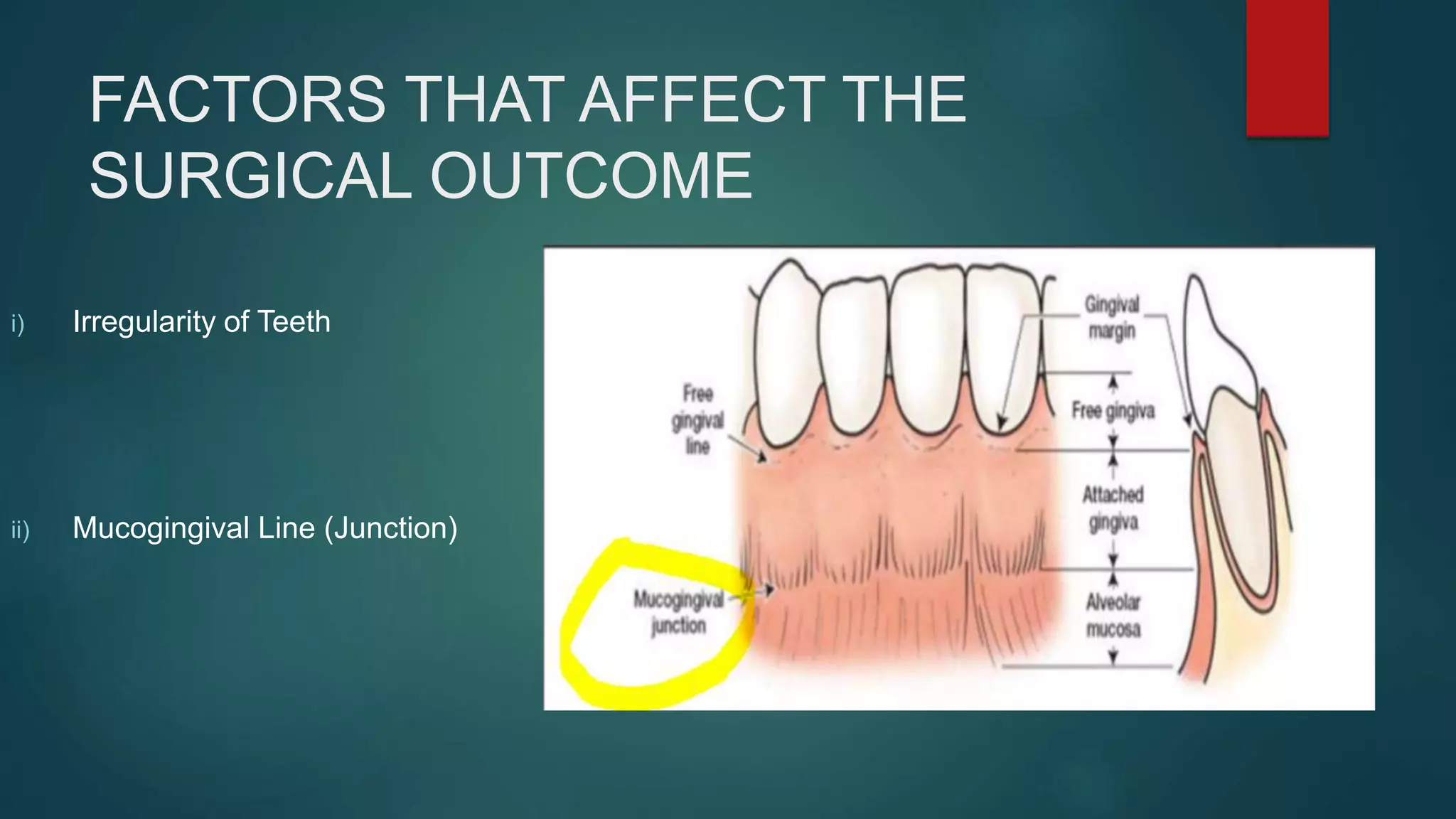 Mucogingival surgery in periodontics | PPTX