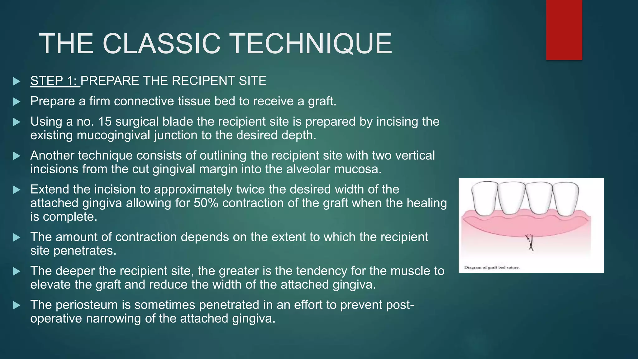 Mucogingival surgery in periodontics | PPTX