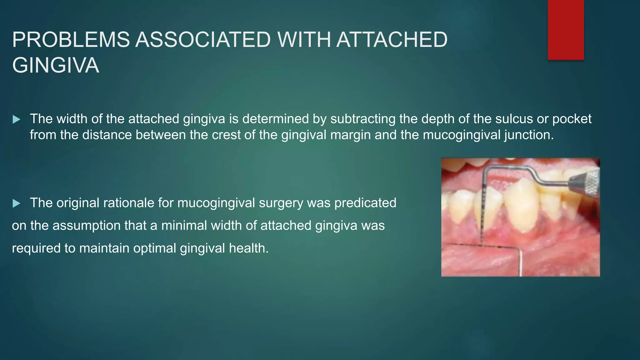 Mucogingival surgery in periodontics | PPTX