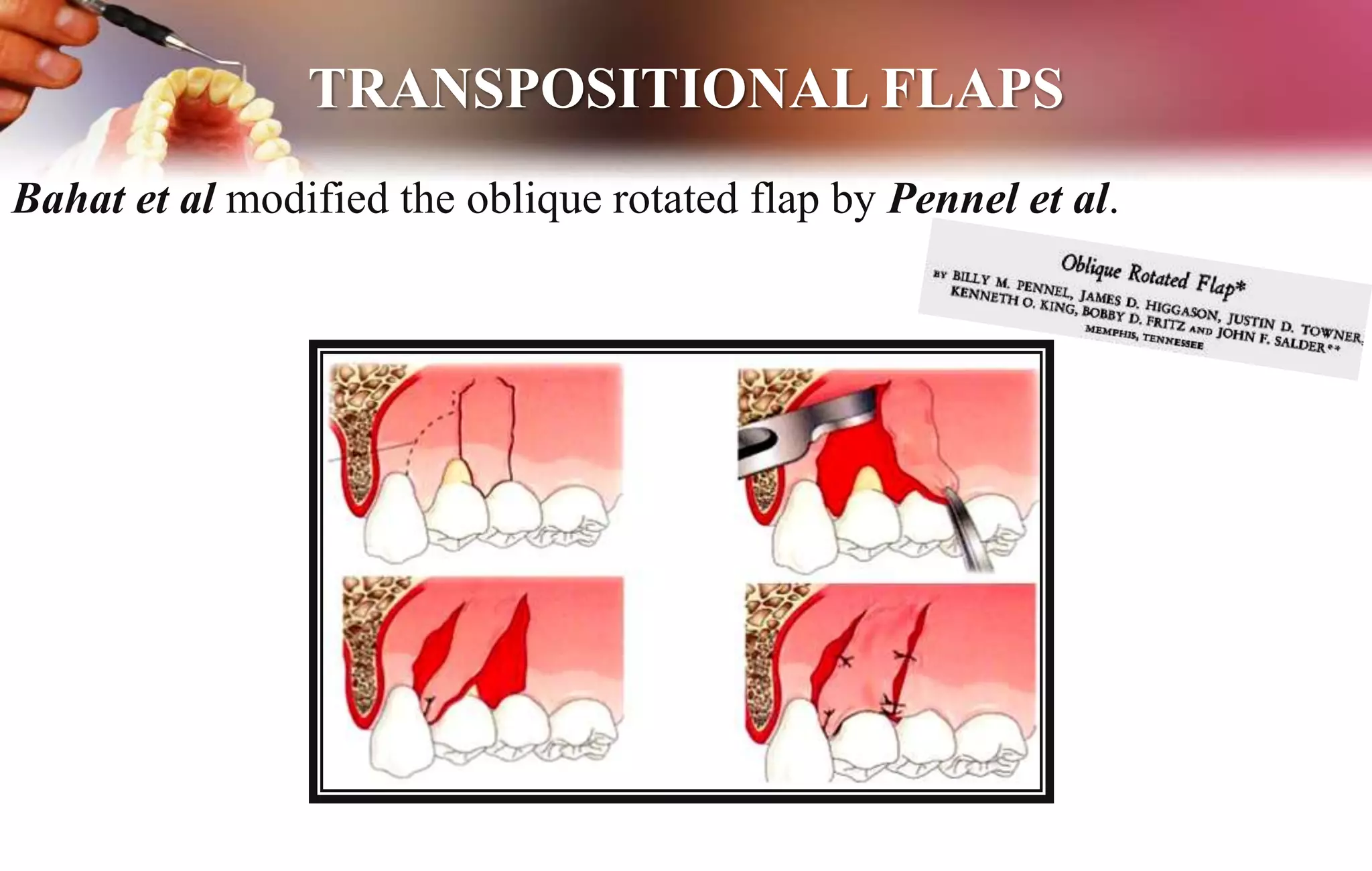 MUCOGINGIVAL SURGERY.pptx