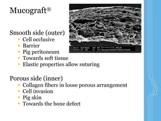 Mucograft® IDA Galway | PPT
