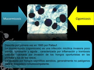 MUCORMICOSIS | PPTX