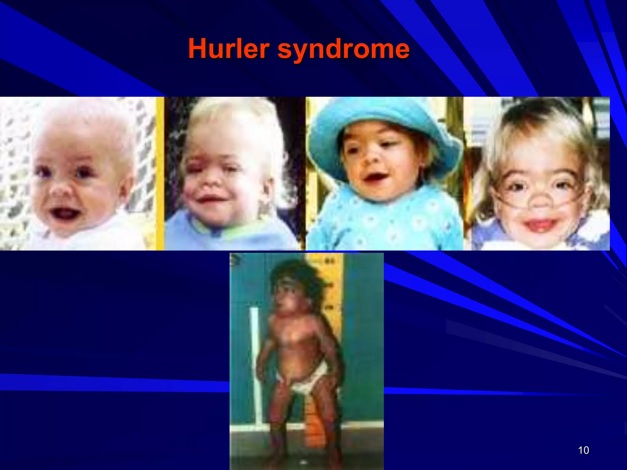 Mucopolysaccharides | PPT