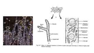 Mucor Slide