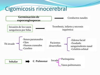 Mucormicosis (cigomicosis) luis r. | PPTX