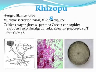 Mucormicosis (cigomicosis) luis r. | PPTX