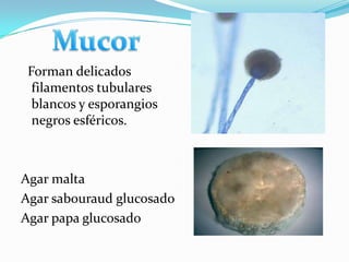 Mucormicosis (cigomicosis) luis r. | PPTX