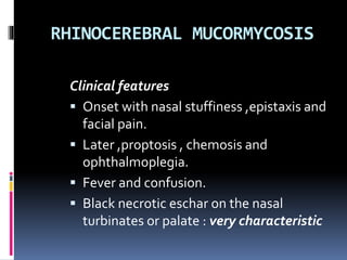 Mucormycosis | PPT